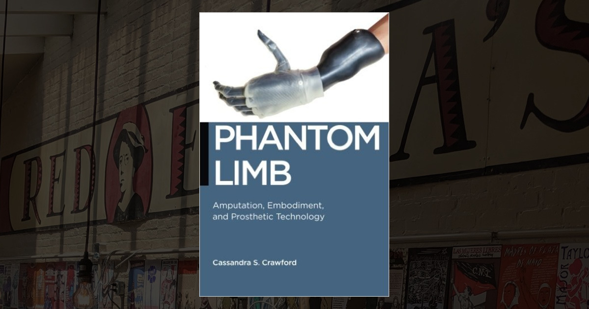 Phantom Limb: Amputation, Embodiment, and Prosthetic Technology